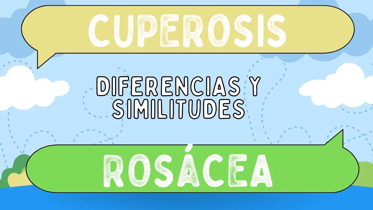 Diferencias entre cuperosis y rosácea